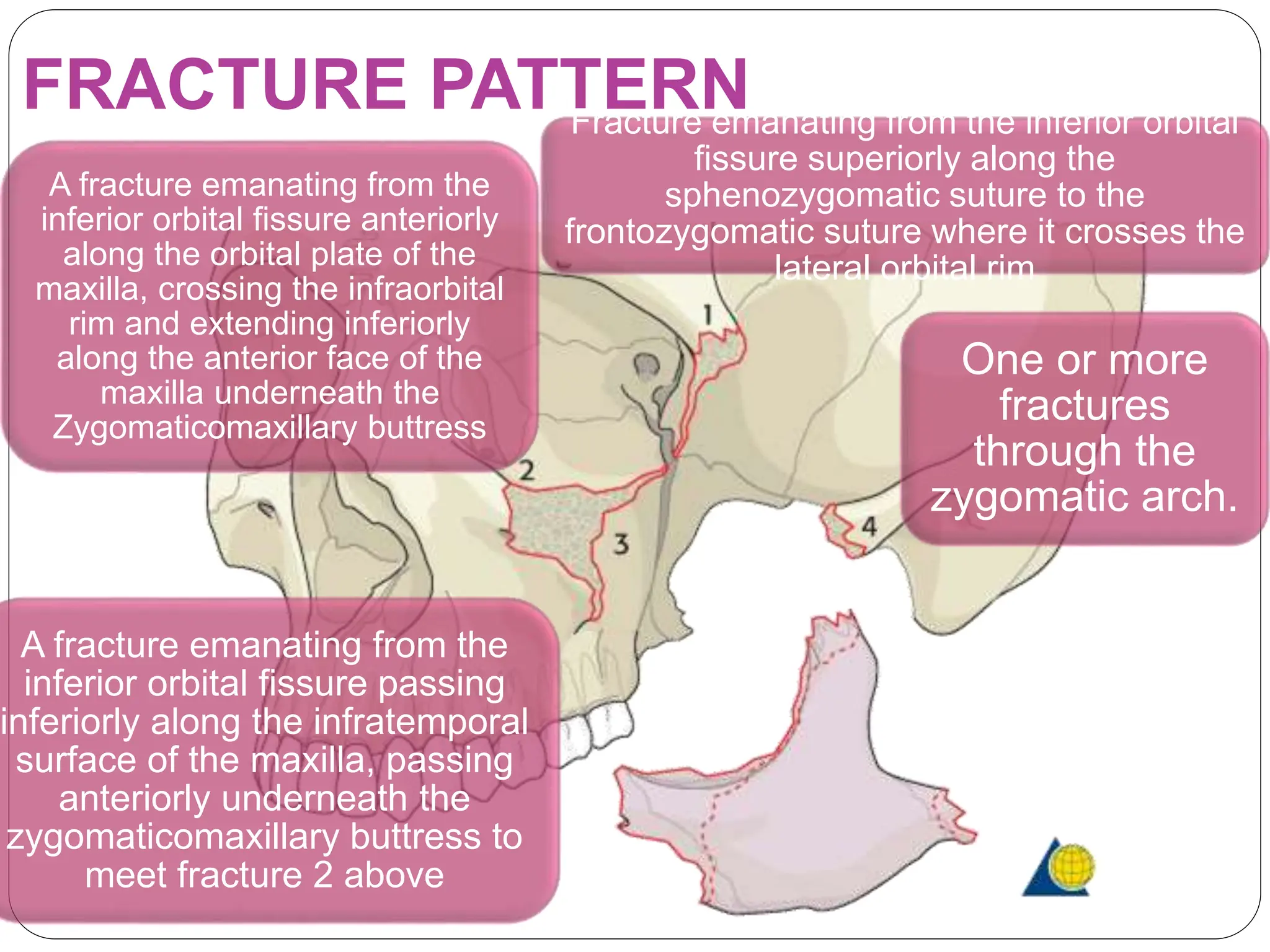 FRACTURES OF THE ZYGOMATIC COMPLEX AND ORBIT.pptx.pptx