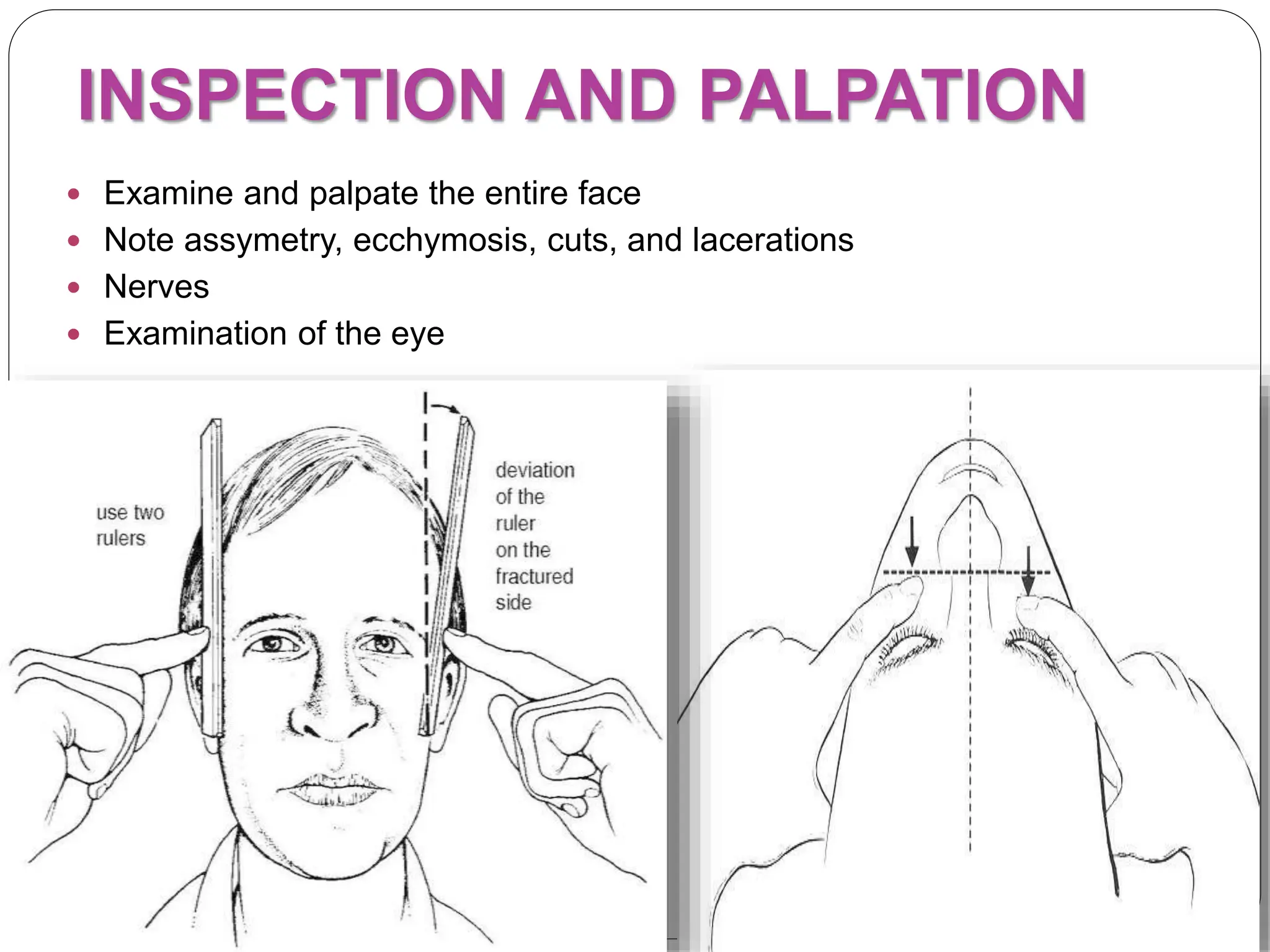 FRACTURES OF THE ZYGOMATIC COMPLEX AND ORBIT.pptx.pptx