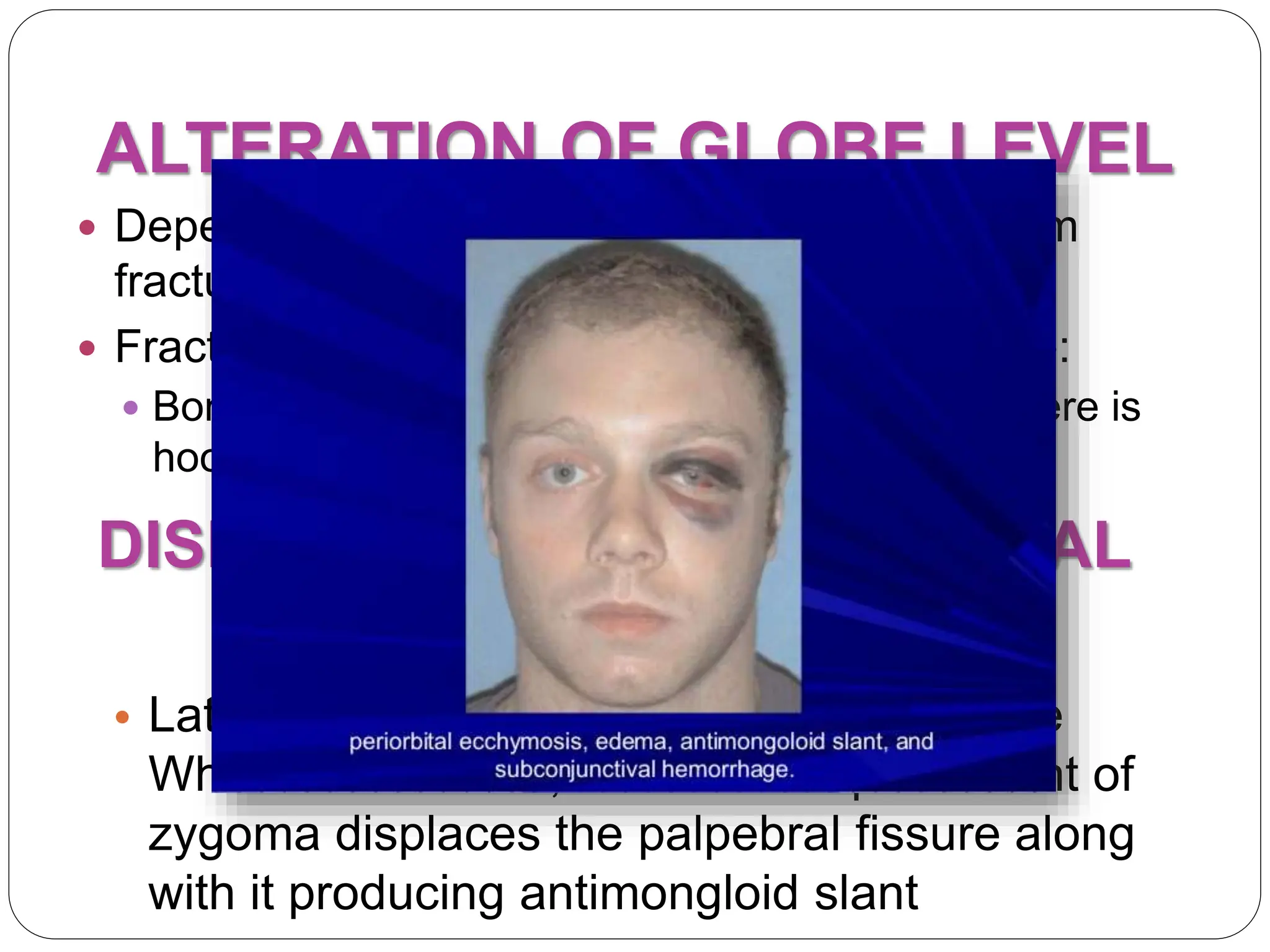 FRACTURES OF THE ZYGOMATIC COMPLEX AND ORBIT.pptx.pptx