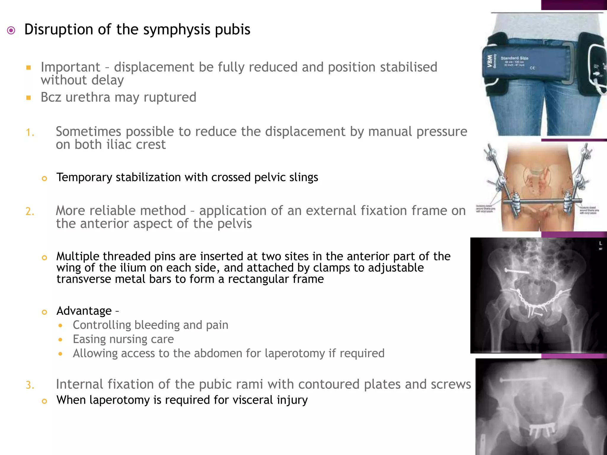 Fractures pelvis.pptx