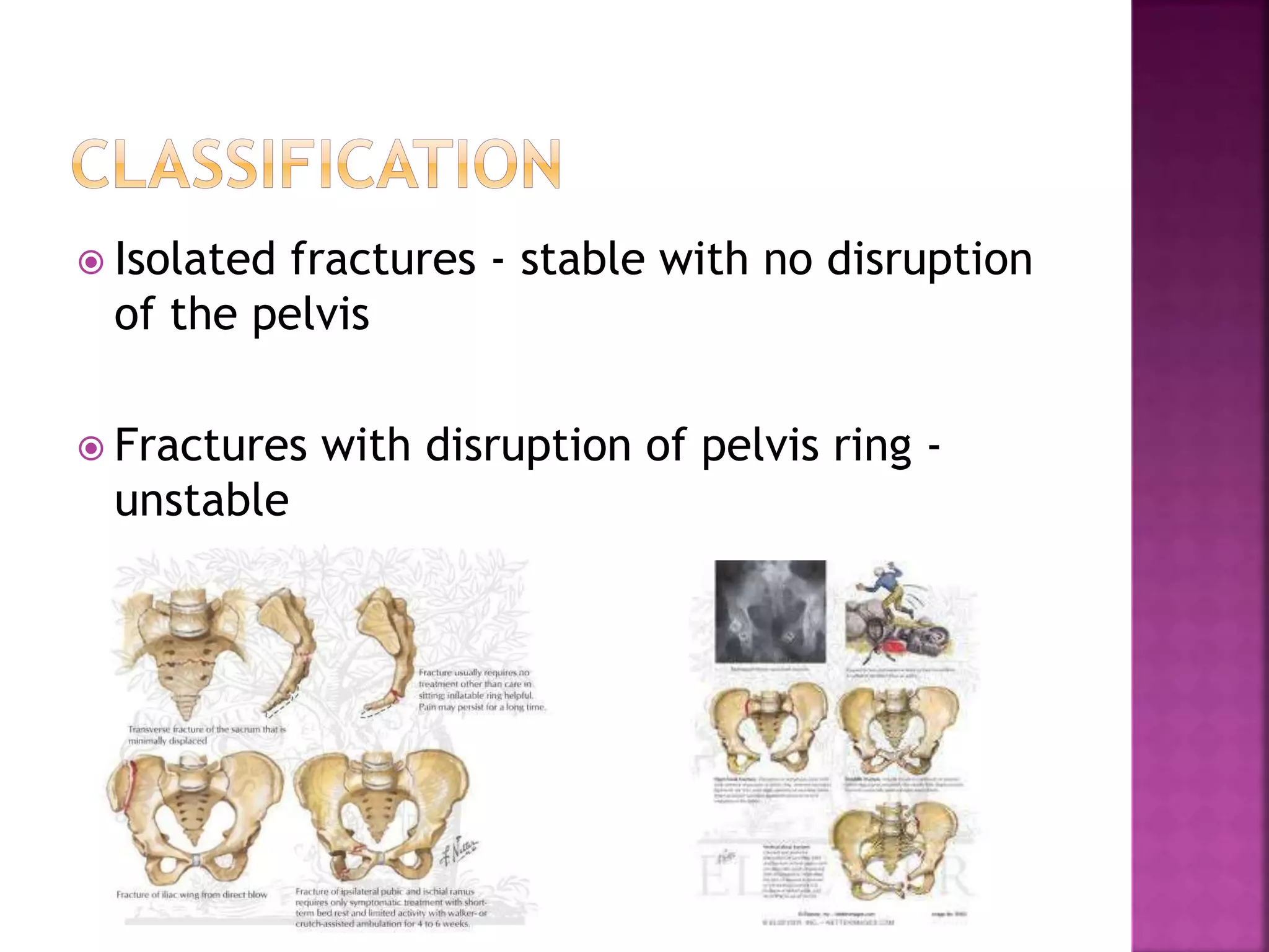 Fractures pelvis.pptx