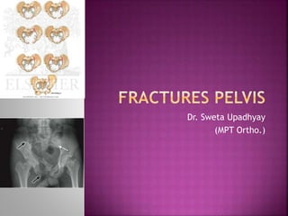 Fractures pelvis.pptx