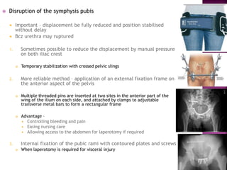 Fractures pelvis.pptx