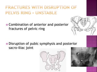 Fractures pelvis.pptx
