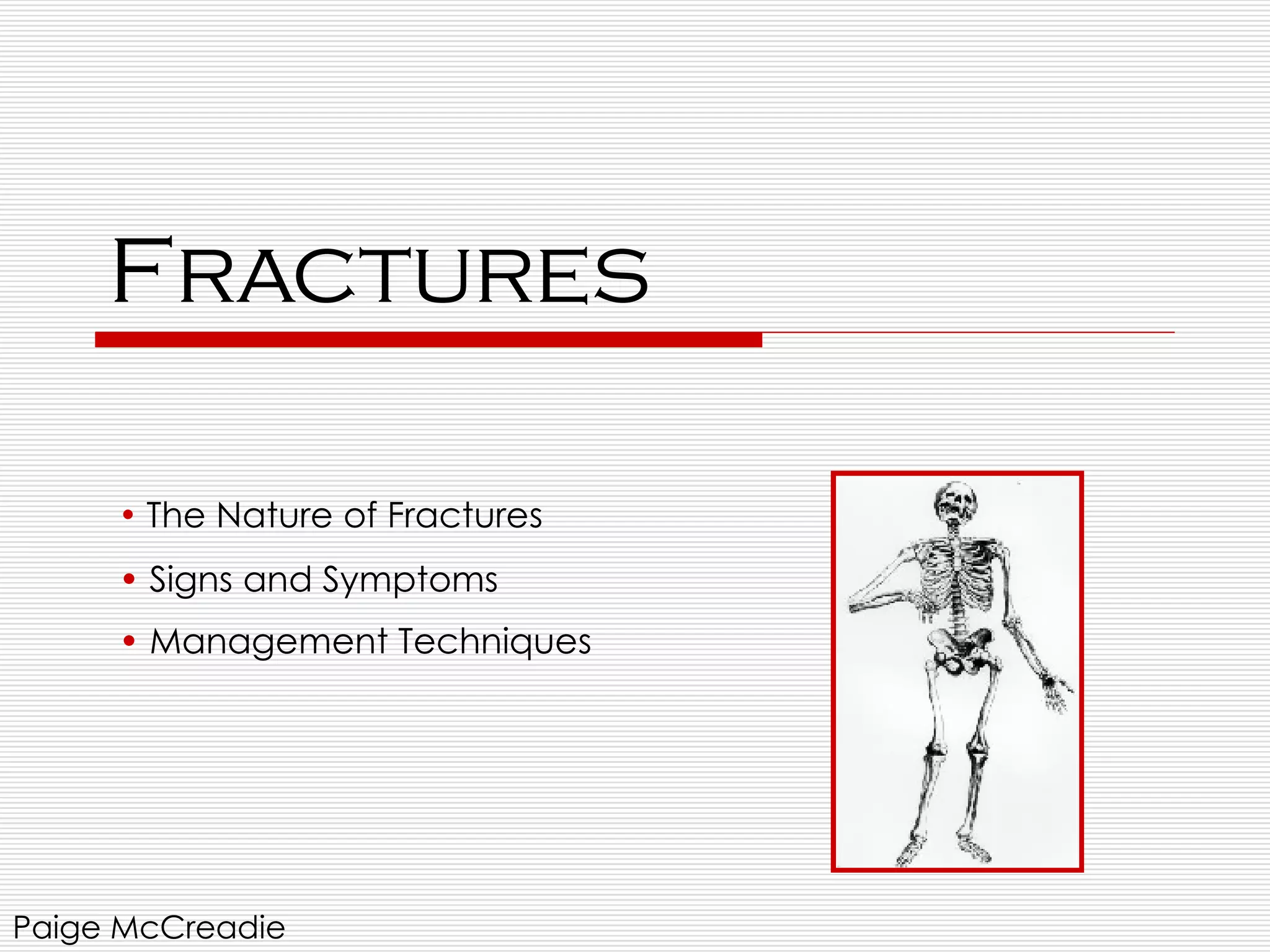 Fractures | PPT