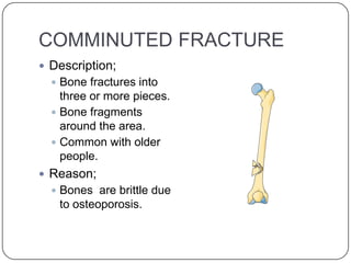 Fractures Presentation | PPTX