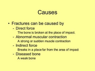 Fractures | PPT | Death, Injury, or Military Conflict | Sensitive Topics