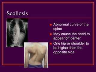 Fractures & Skeletal Conditions | PPT