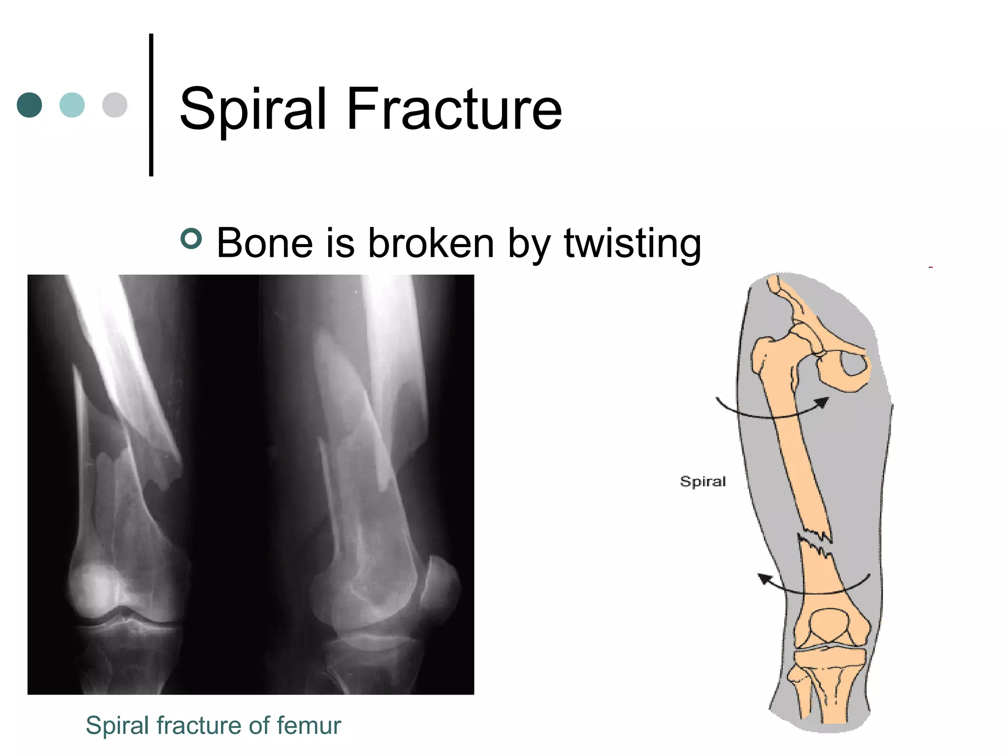 Fractures sprains and dislocations | PPS
