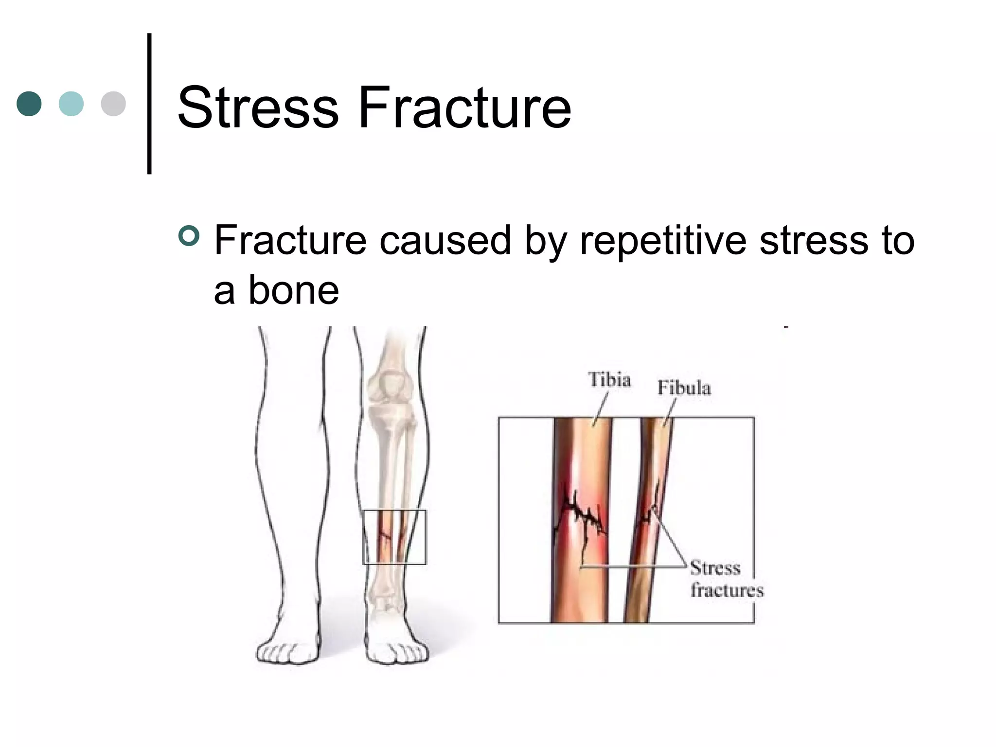Fractures sprains and dislocations | PPS