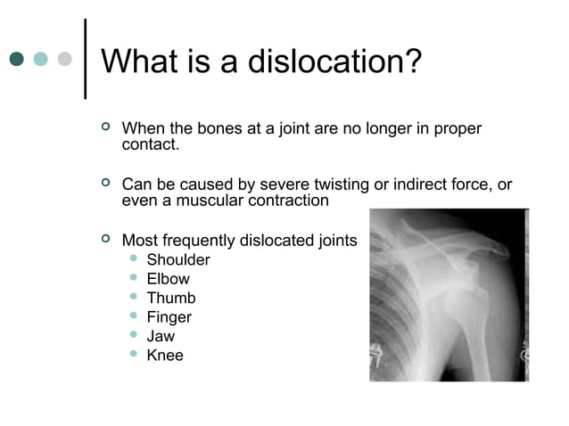 Fractures sprains and dislocations | PPS | First Aid | Injuries