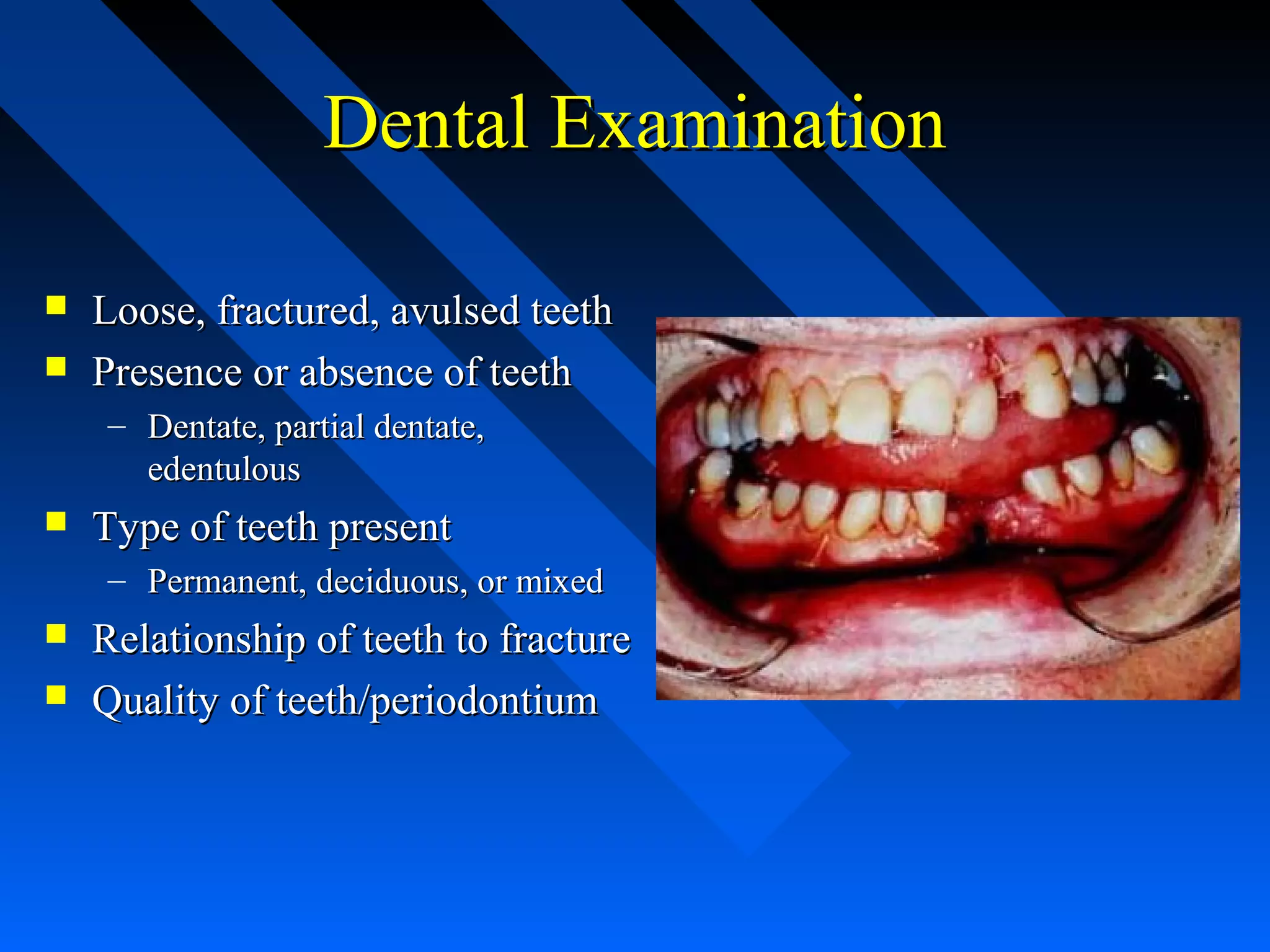 Fracture stabilization | PPT