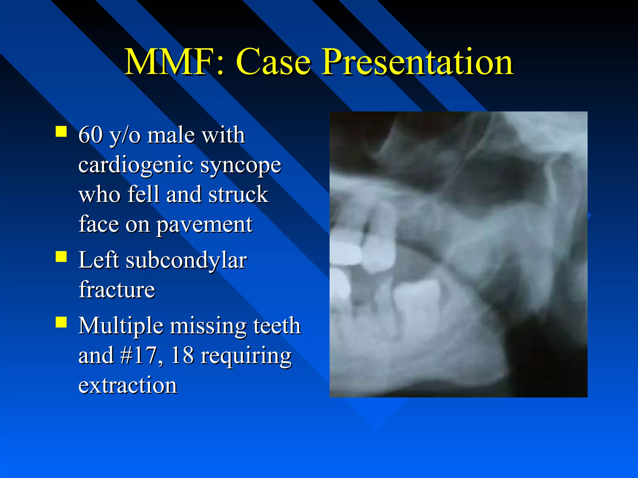 Fracture stabilization | PPT
