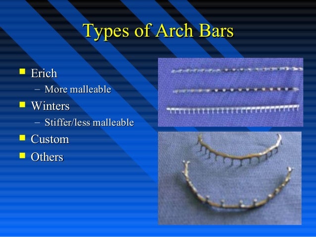 Fracture stabilization