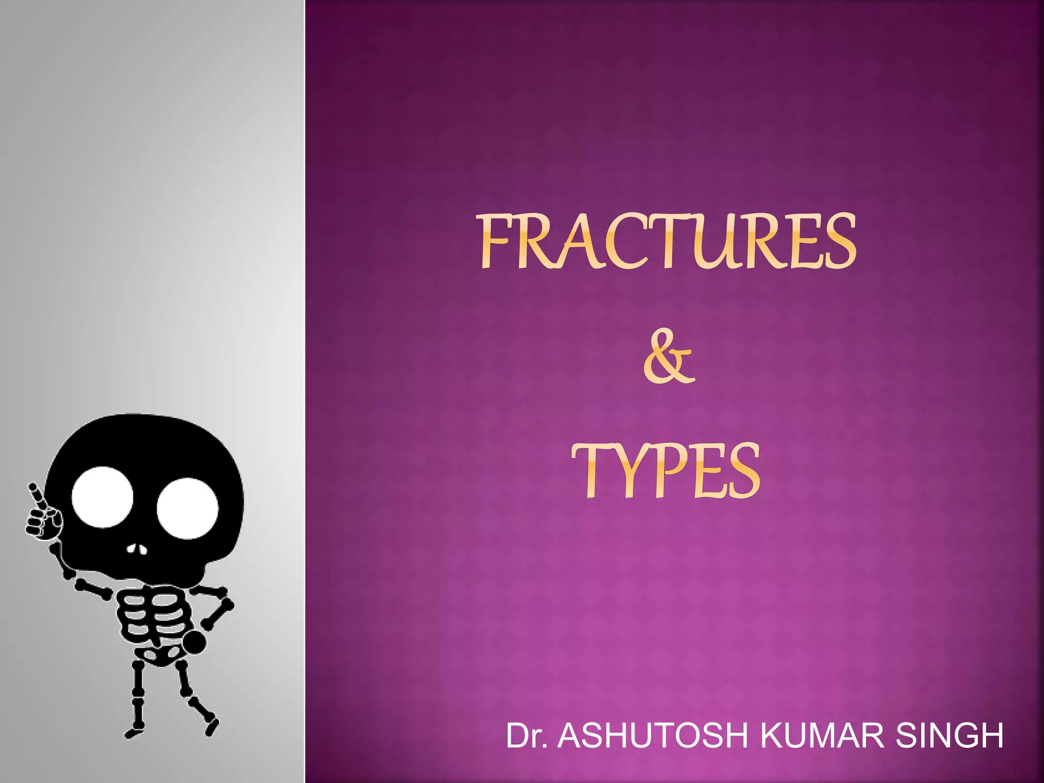 Fractures and types | PPTX