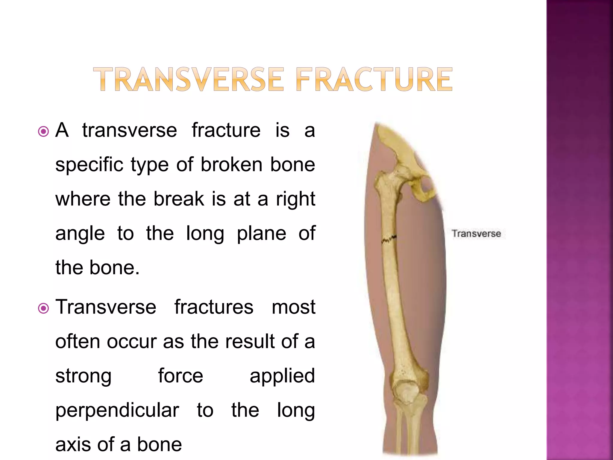 Fractures and types | PPTX