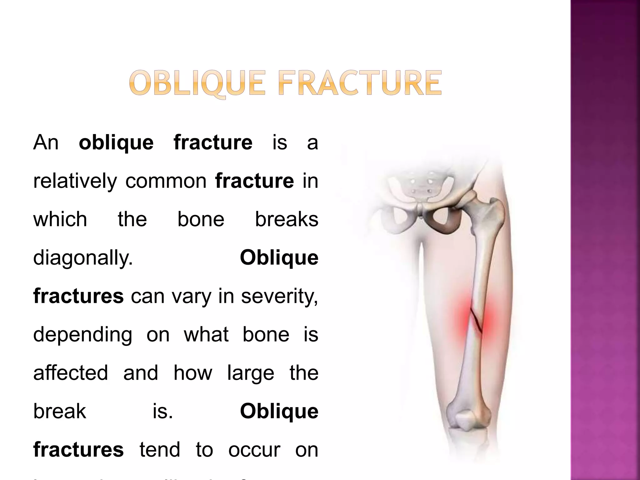 Fractures and types | PPTX