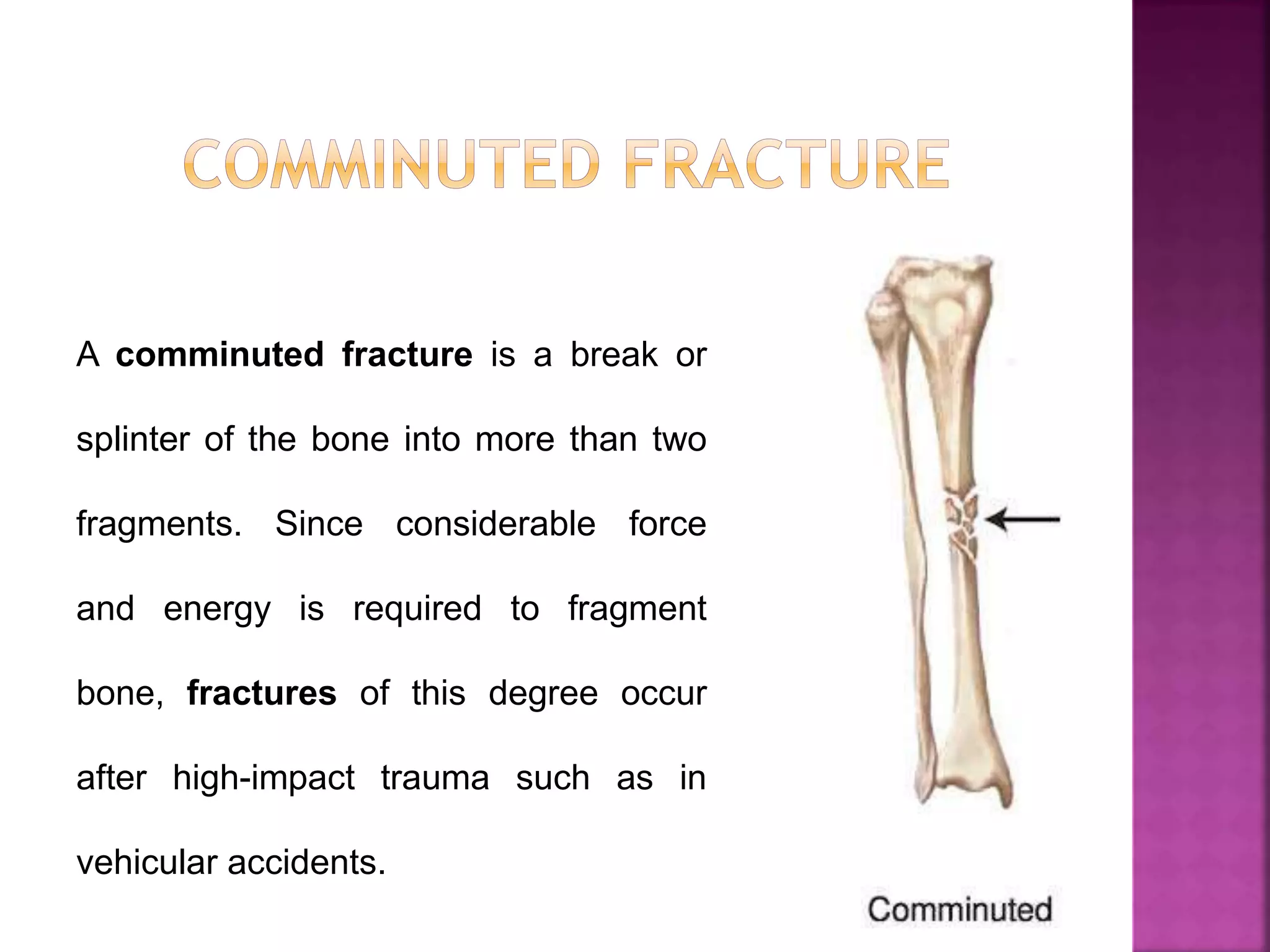 Fractures and types | PPTX