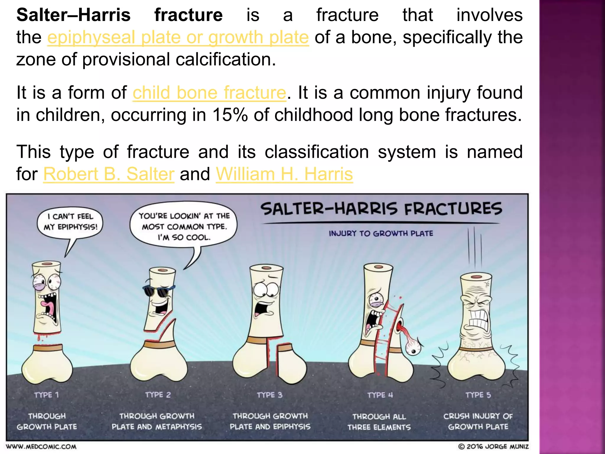 Fractures and types | PPTX