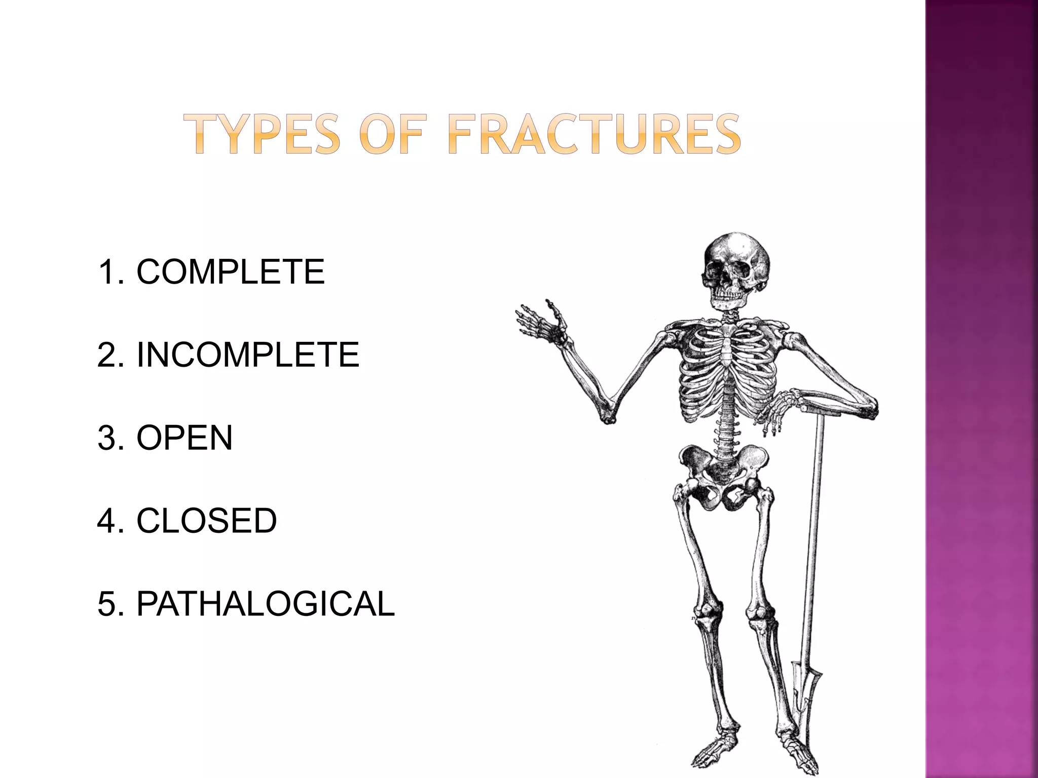 Fractures and types | PPTX