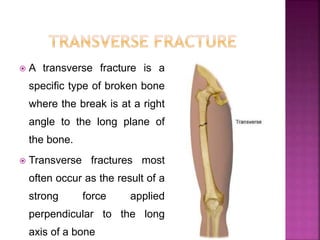 Fractures and types | PPTX
