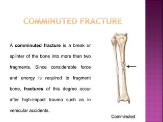 Fractures and types | PPTX