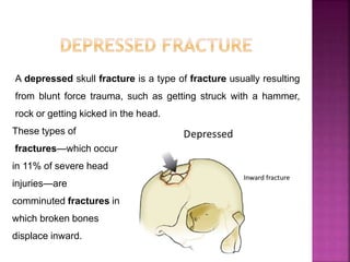 Fractures and types | PPTX