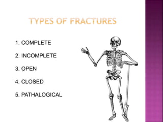 Fractures and types | PPTX