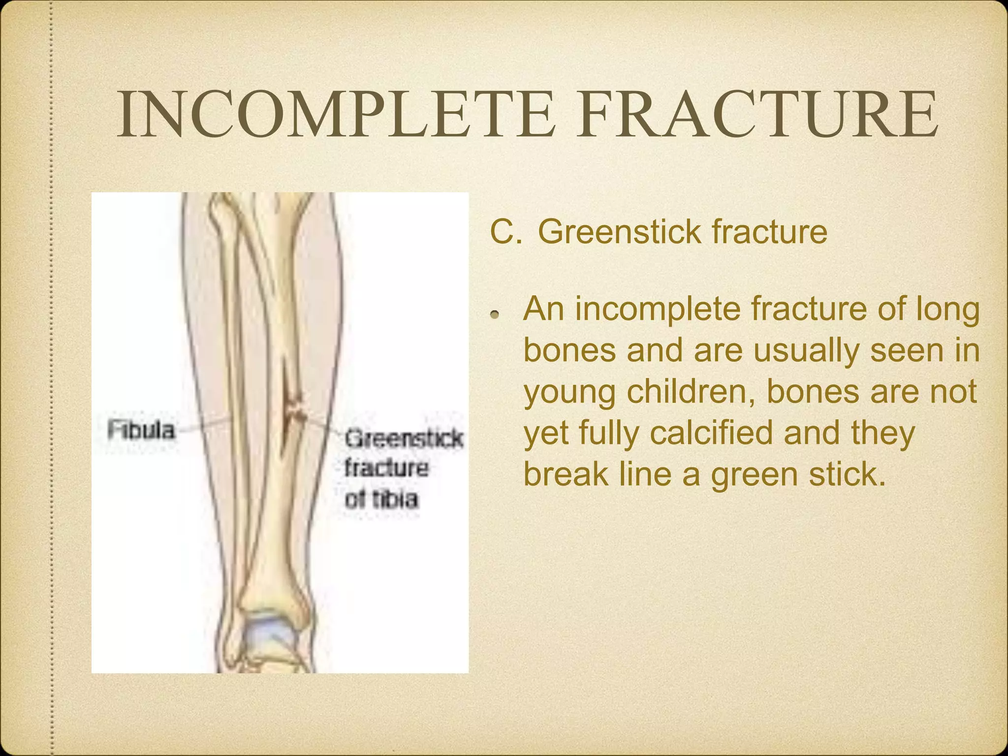 Fractures, types and lower extremities | PPTX