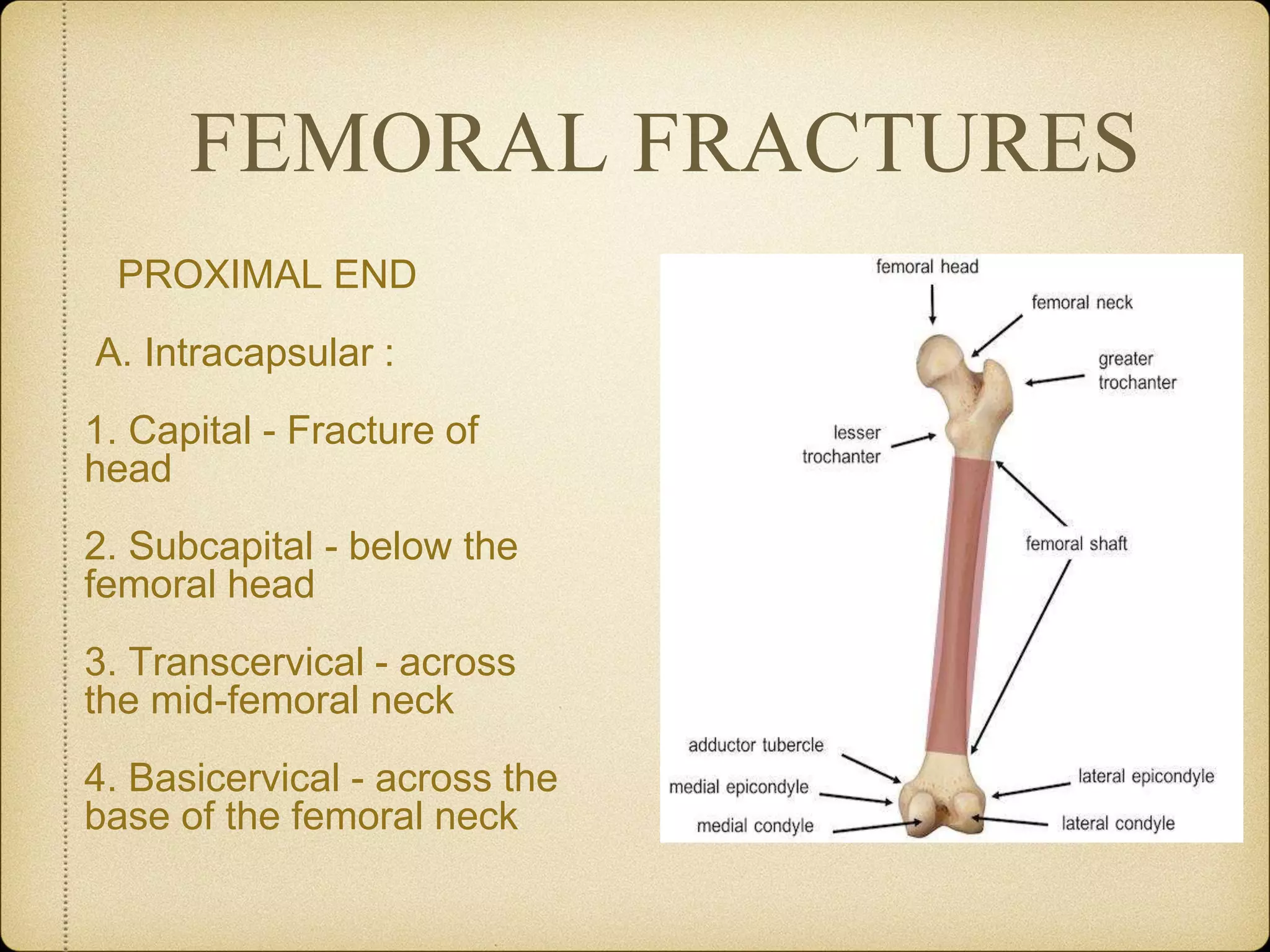 Fractures, types and lower extremities | PPTX