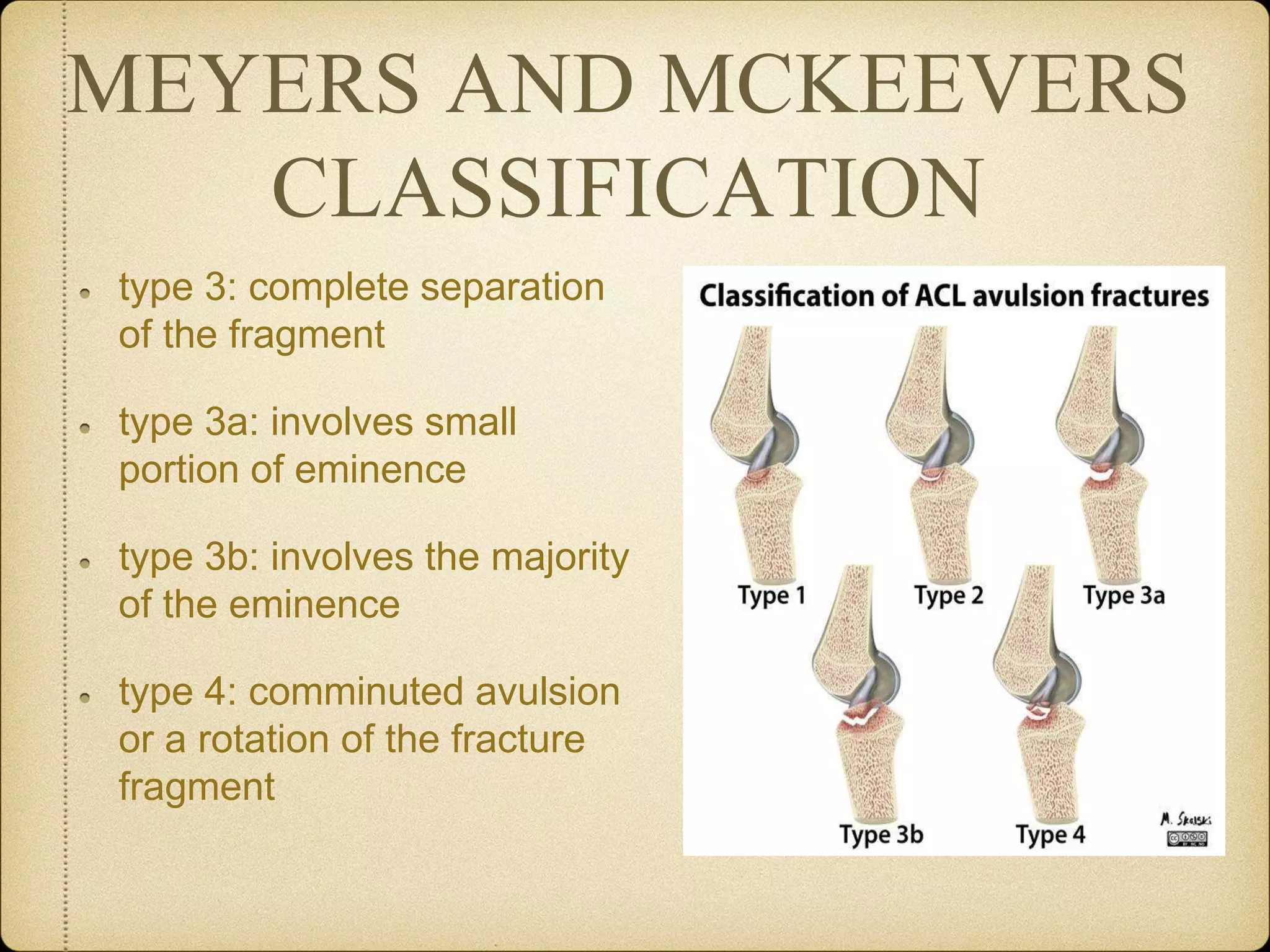 Fractures, types and lower extremities | PPTX