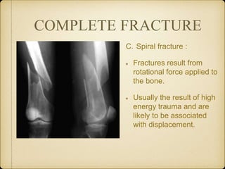 Fractures, types and lower extremities | PPTX