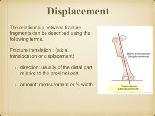 Fractures, types and lower extremities | PPTX