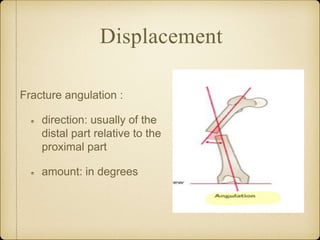 Fractures, types and lower extremities | PPTX