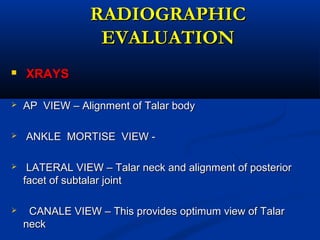 Fracture Talus | PPT