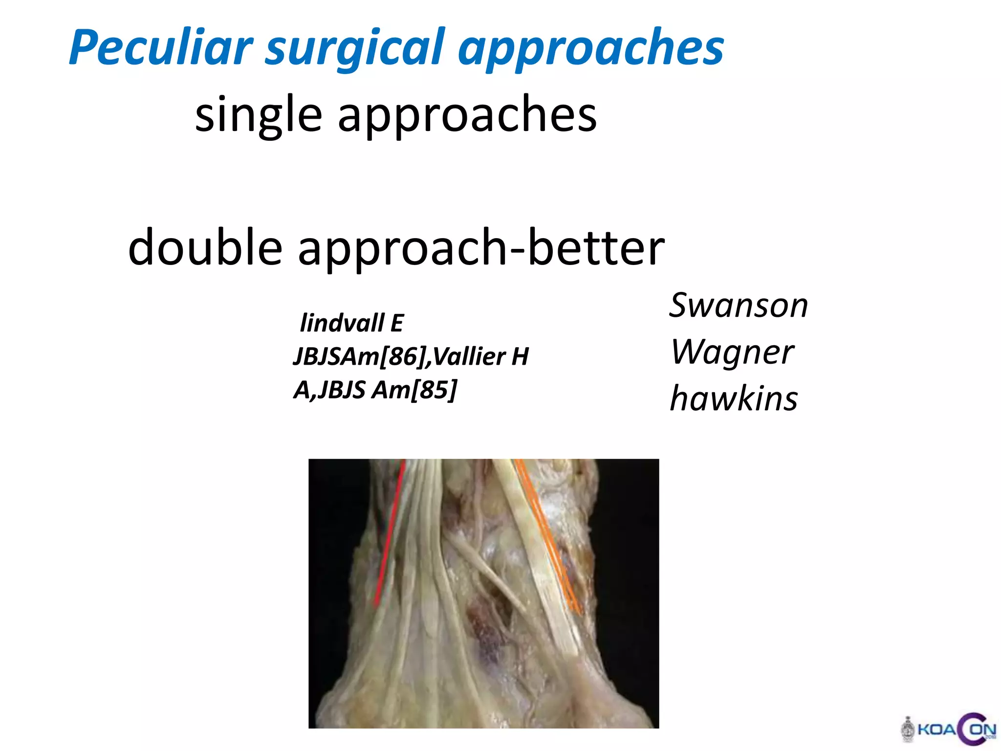 Fracture talus surgical options-dr mohamed ashraf-hod orthopaedics govt ...