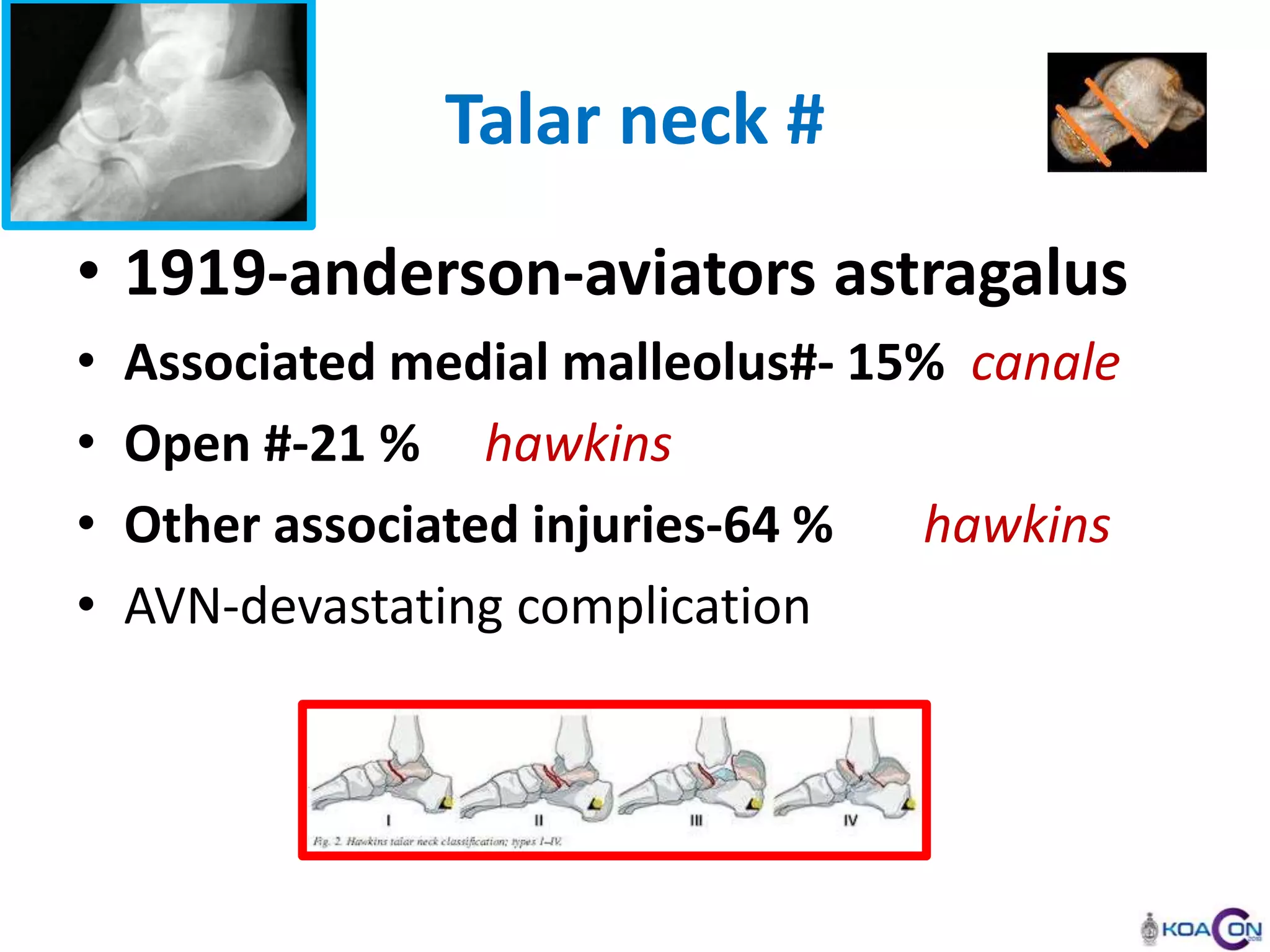 Fracture talus surgical options-dr mohamed ashraf-hod orthopaedics govt ...