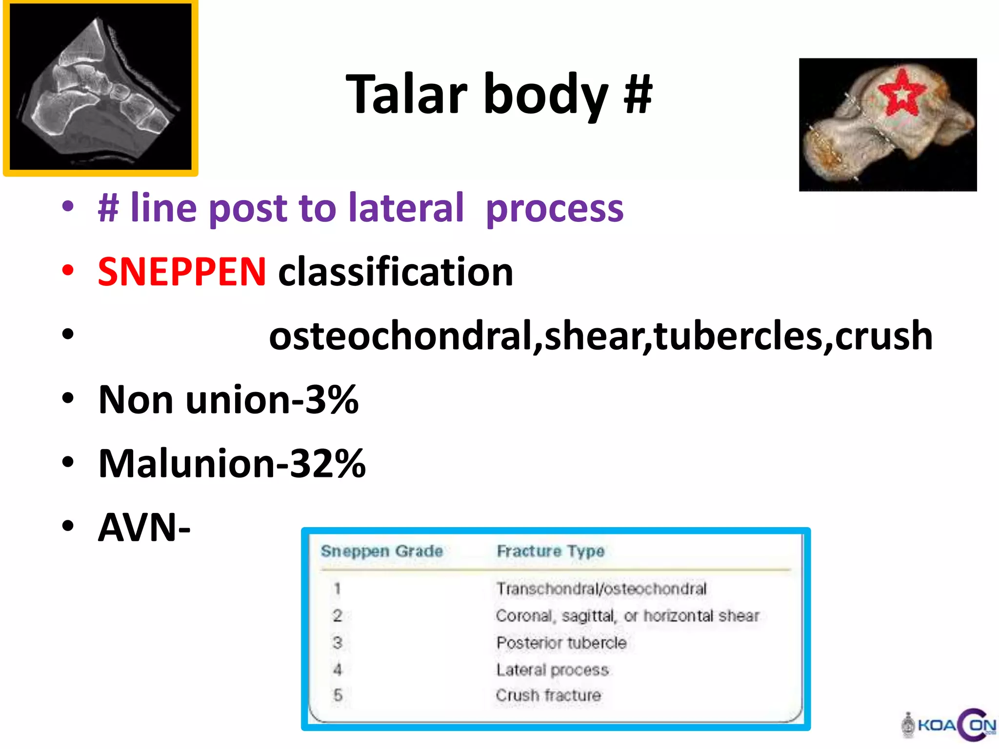 Fracture talus surgical options-dr mohamed ashraf-hod orthopaedics govt ...