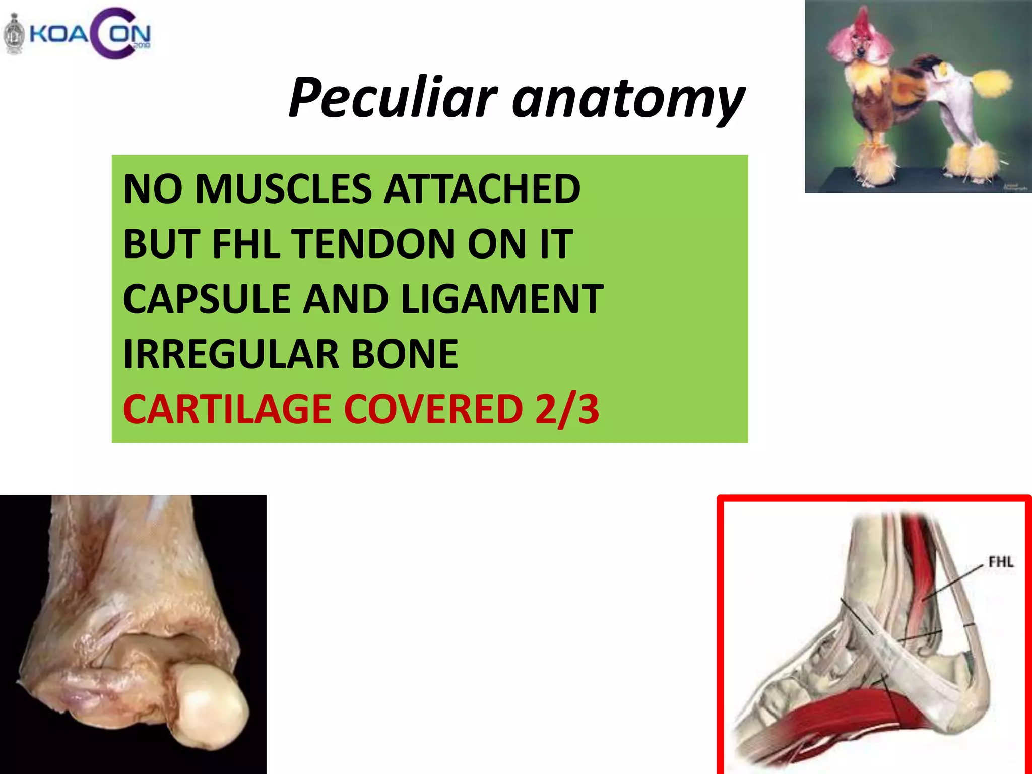 Fracture talus surgical options-dr mohamed ashraf-hod orthopaedics govt ...