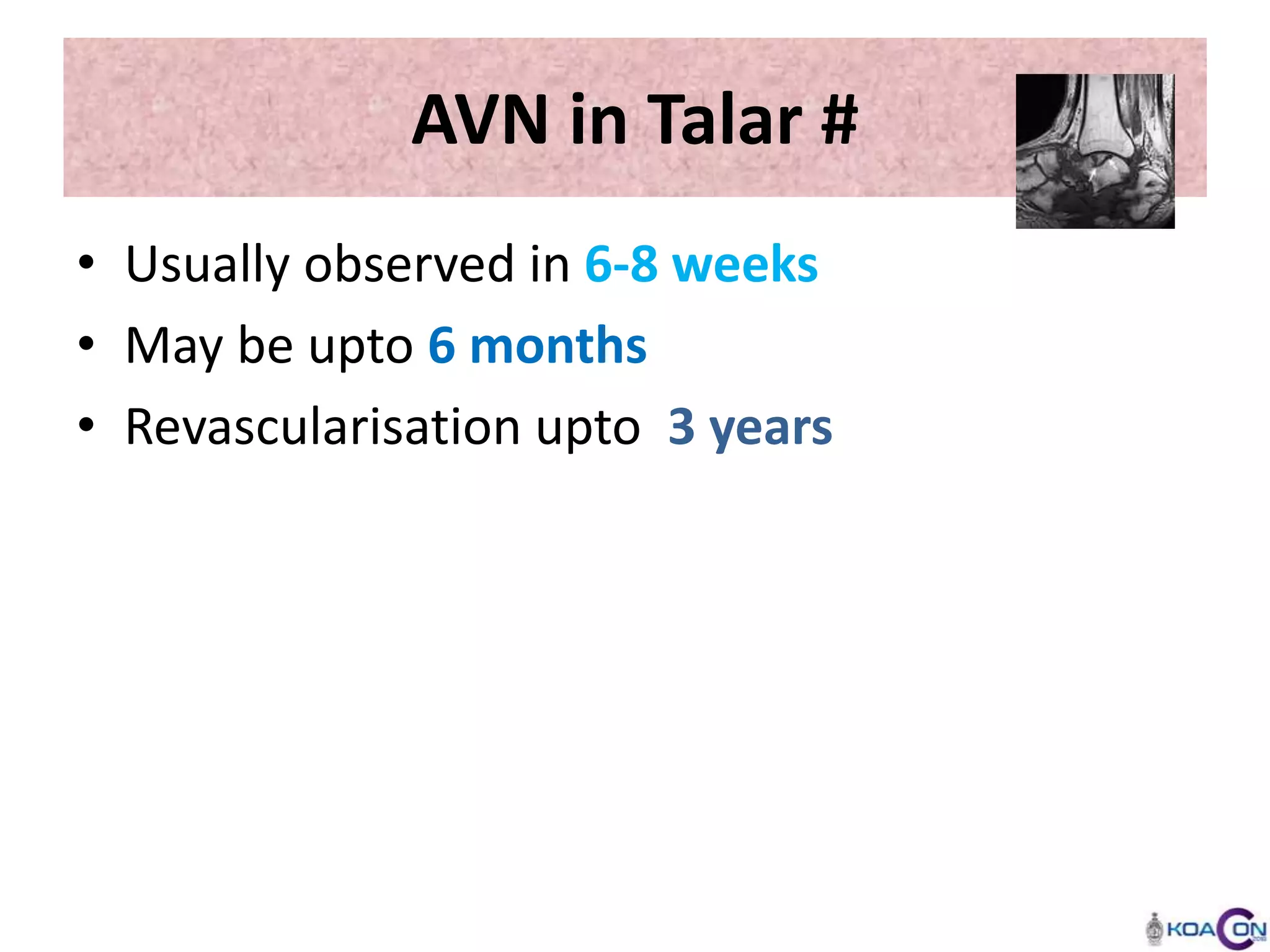 Fracture talus surgical options-dr mohamed ashraf-hod orthopaedics govt ...