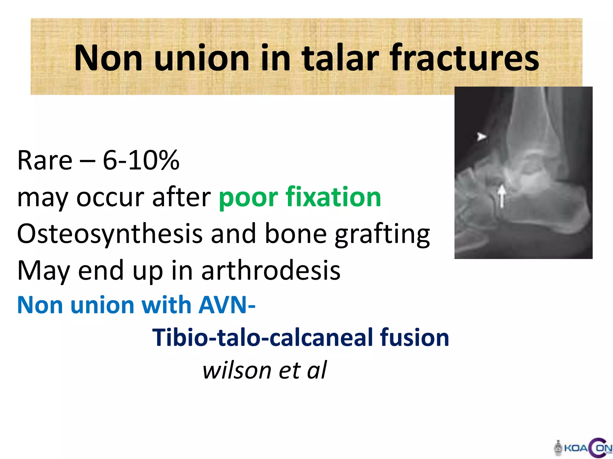 Fracture talus surgical options-dr mohamed ashraf-hod orthopaedics govt ...