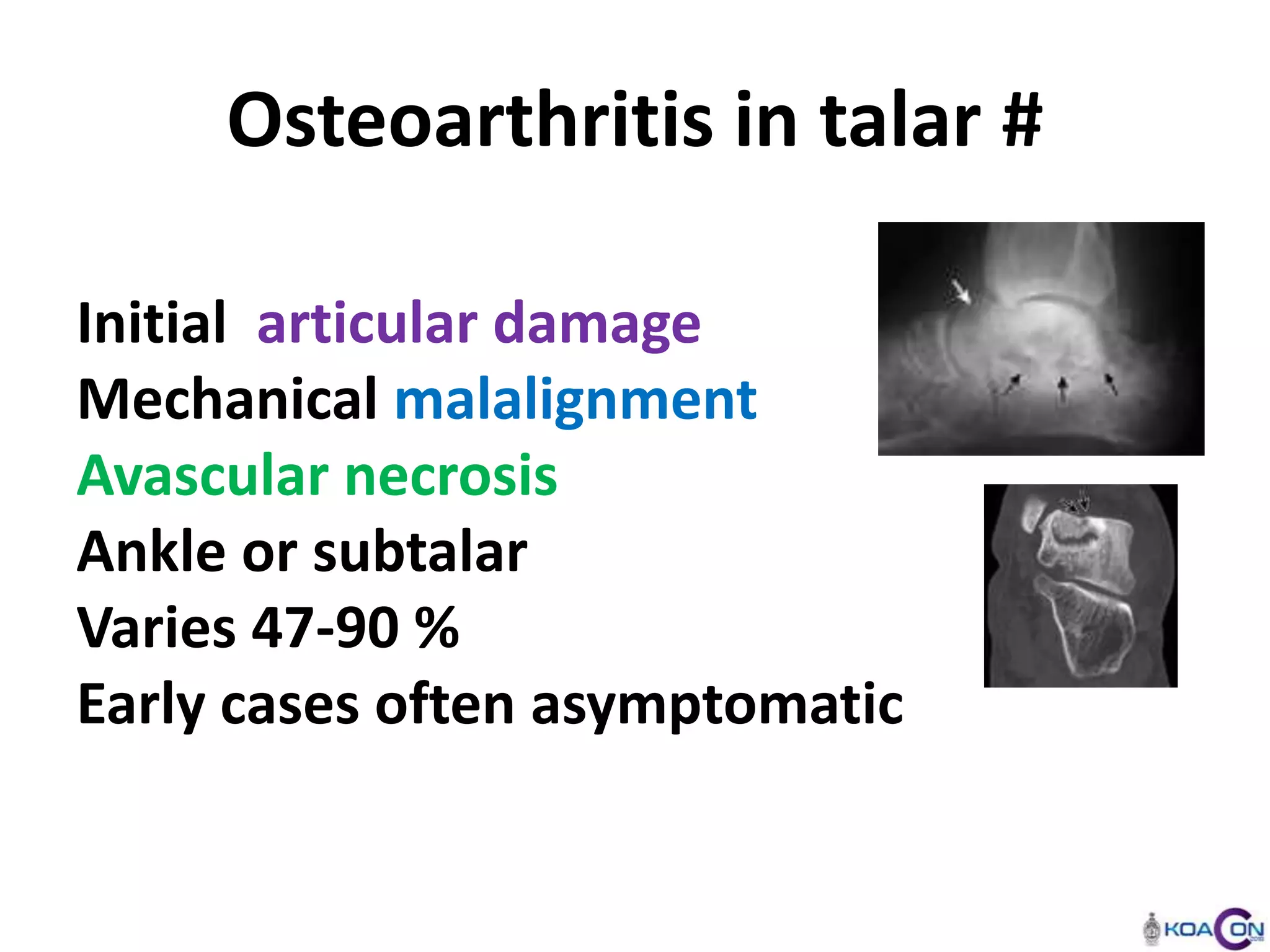 Fracture talus surgical options-dr mohamed ashraf-hod orthopaedics govt ...