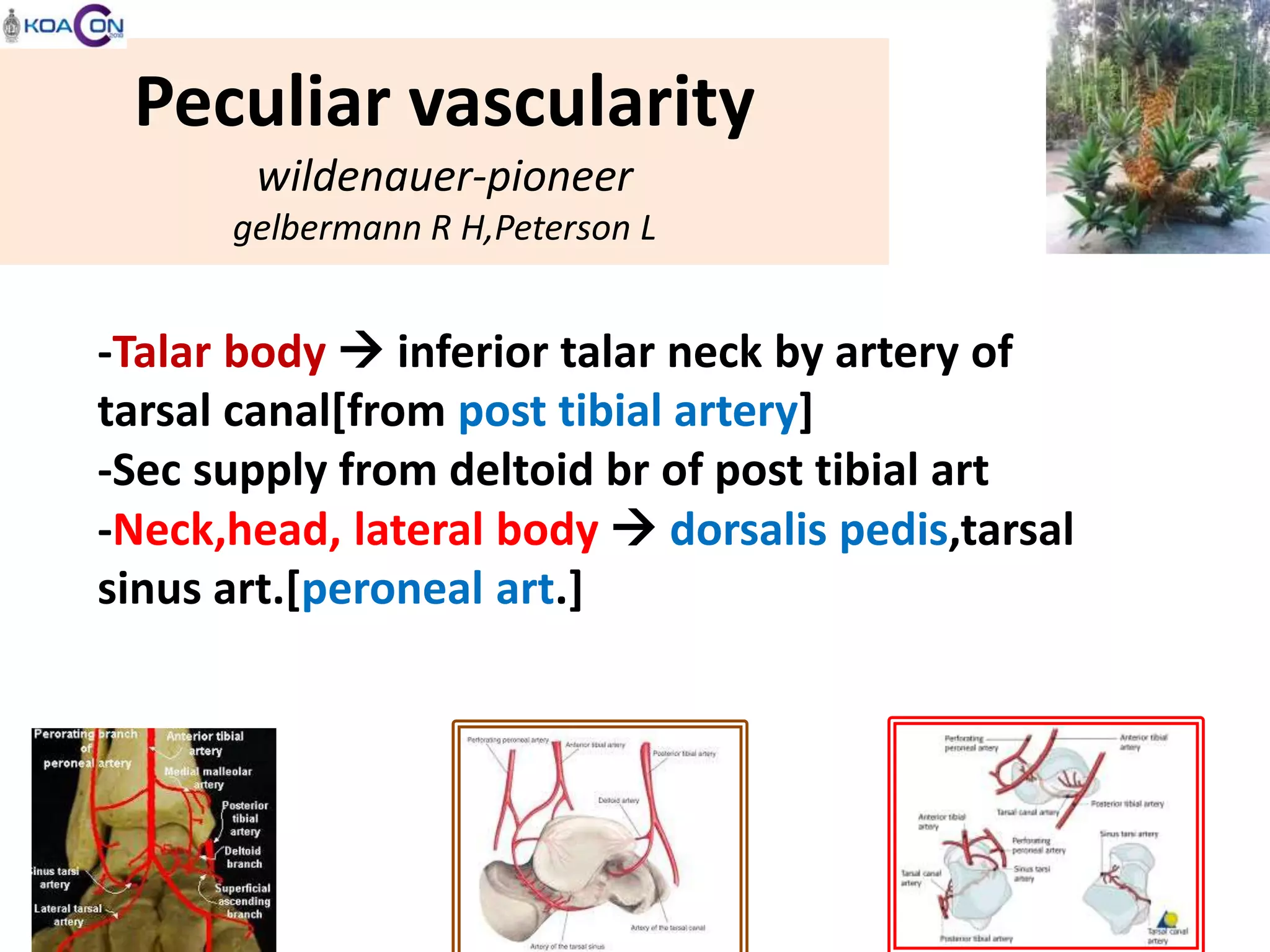Fracture talus surgical options-dr mohamed ashraf-hod orthopaedics govt ...