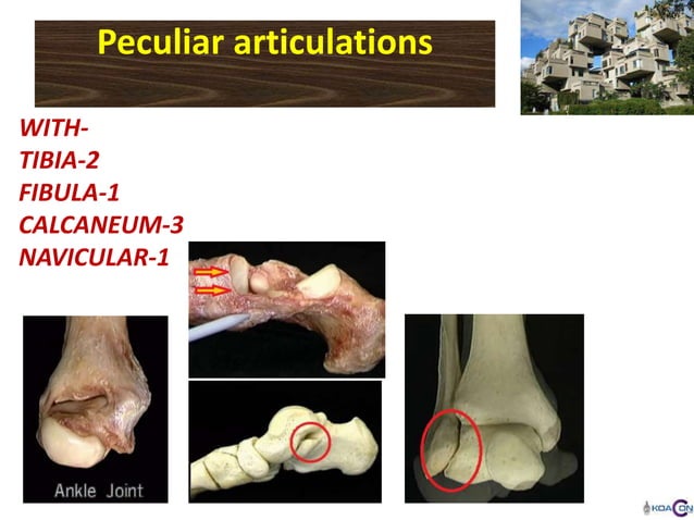 Fracture talus surgical options-dr mohamed ashraf-hod orthopaedics govt ...