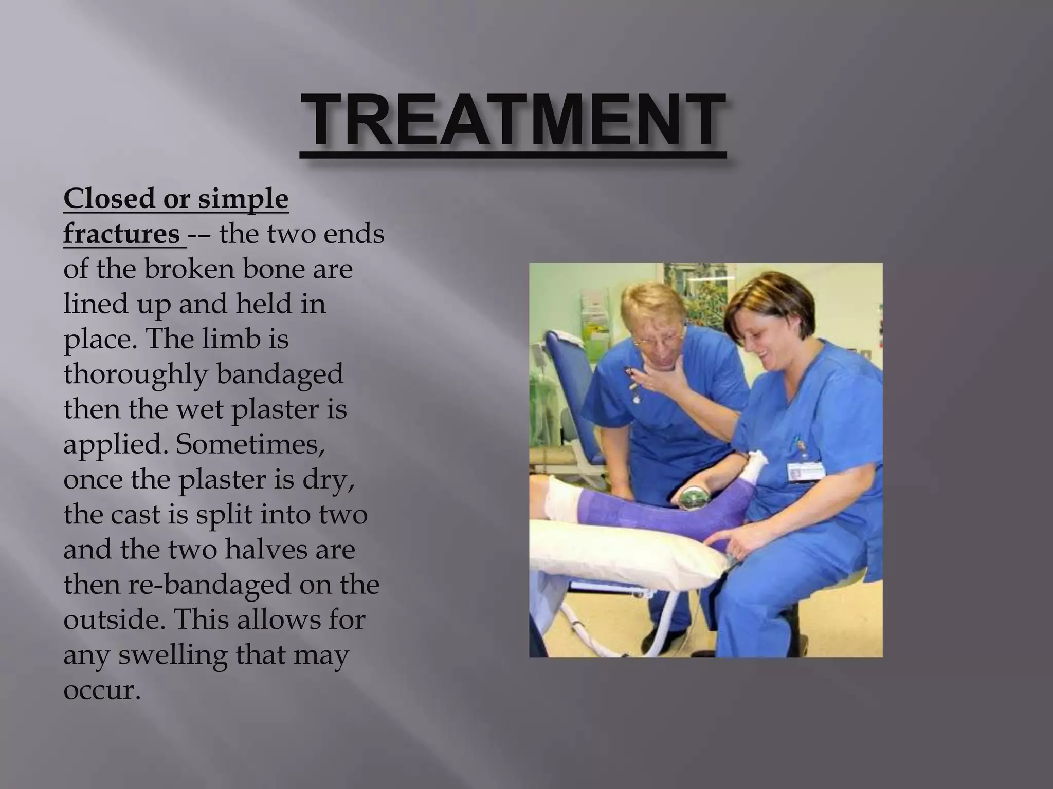 Bone Fracture Types by Nadia Abdulallah | PPTX
