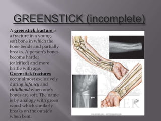 Bone Fracture Types by Nadia Abdulallah | PPTX