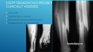 FRACTURE X RAY INTERPRETATION FOR MEDICAL STUDENTS.ppt
