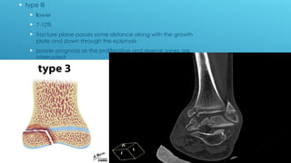 FRACTURE X RAY INTERPRETATION FOR MEDICAL STUDENTS.ppt