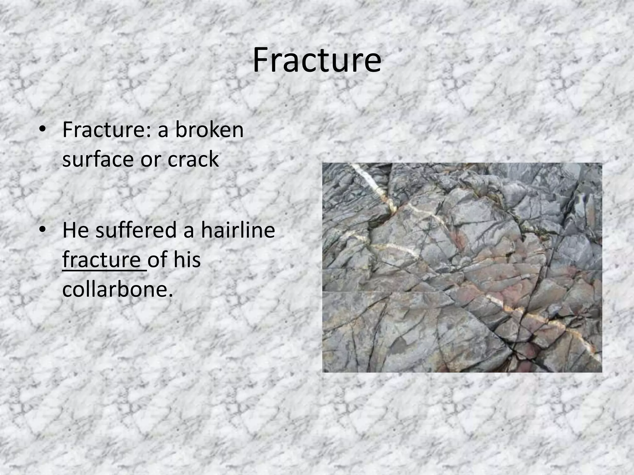 Frag Vocabulary | PPT