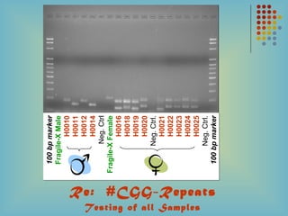 Fragile X Syndrome Mutation by Methylation Sensitive PCR | PPT ...